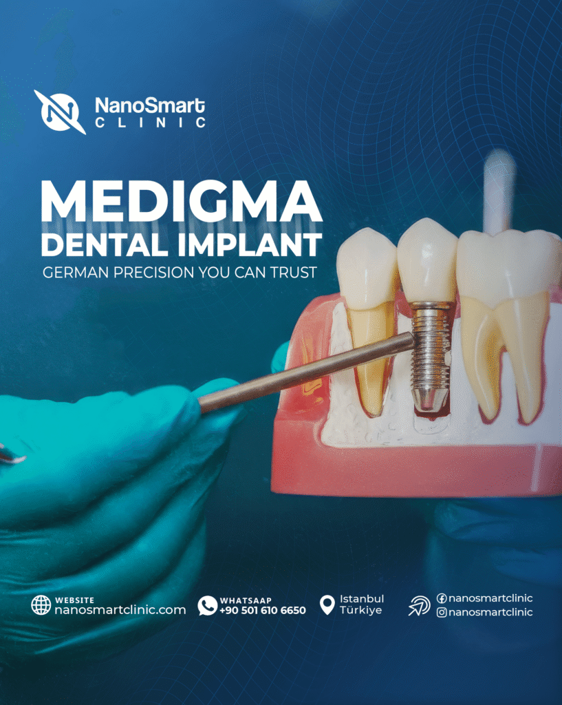 What is Medigma Dental Implants? - Nano Smart Clinic